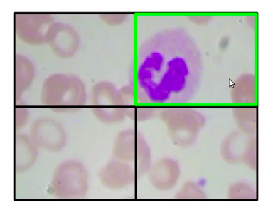 Blood Cell Detection in Image Using Naive Approach - Analytics Vidhya