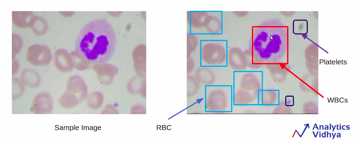 Blood Cell Detection in Image Using Naive Approach - Analytics Vidhya