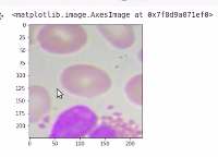 Blood Cell Detection in Image Using Naive Approach - Analytics Vidhya