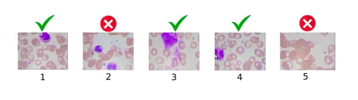 Blood Cell Detection in Image Using Naive Approach - Analytics Vidhya
