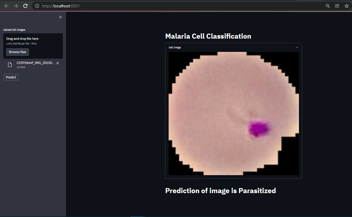 Malaria Cell Image Classification - An End-to-End Prediction