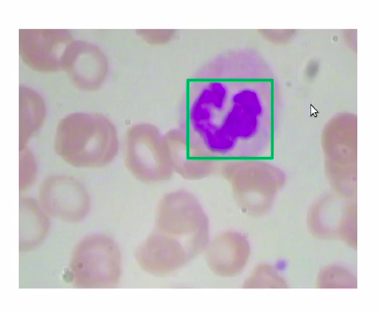 Blood Cell Detection in Image Using Naive Approach - Analytics Vidhya